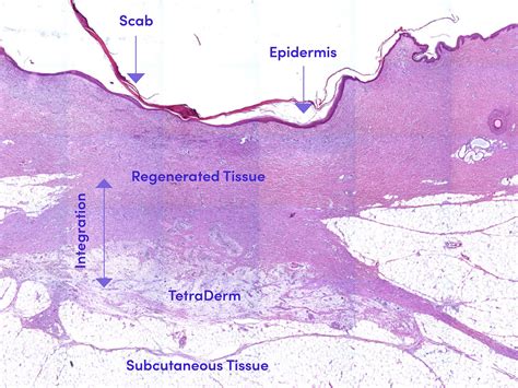 Tissue Healing Tetratherix