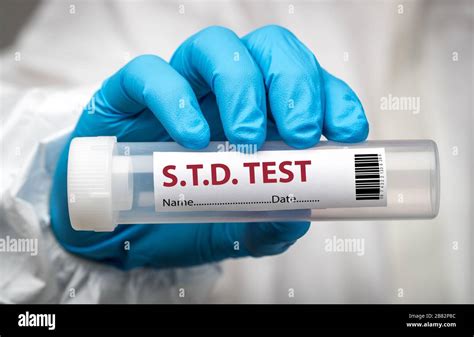 Swab Test Std At Rebecca Bowens Blog