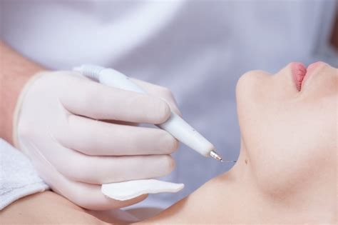 Лазерная биоревитализация лица на аппарате Vitalaser в Москве
