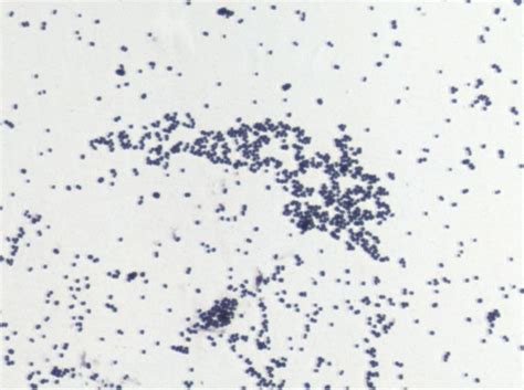 Peptoniphilus Alchetron The Free Social Encyclopedia