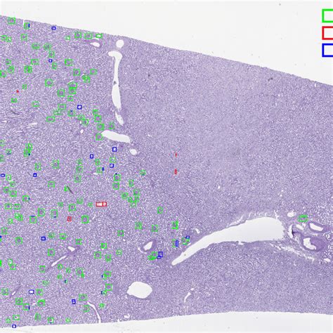 The Yolov3 Architecture With Darknet 53 As Backbone The Architecture Download Scientific