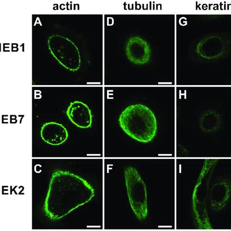 The Distribution Of Cytoskeletal Elements Actin Filaments A C