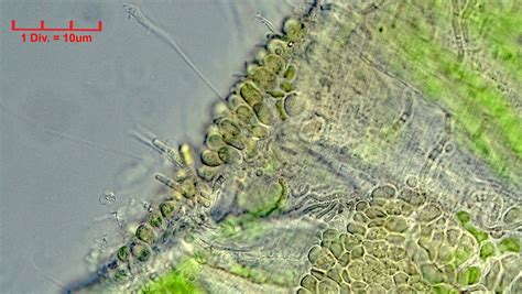 Cyanobacteria Pleurocapsales Dermocarpellaceae Cyanocystis Violaceae Cyanocystis Violaceae 156 