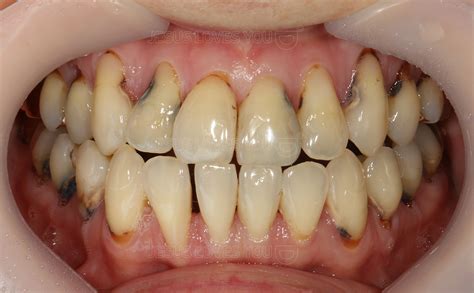 하루에 치료하는 치과 하루에치과