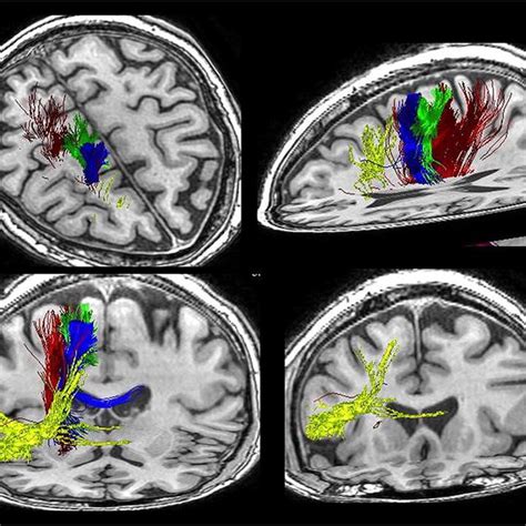 Different Subcortical Connections Of The SMA Pre SMA Direct Motor Download Scientific Diagram