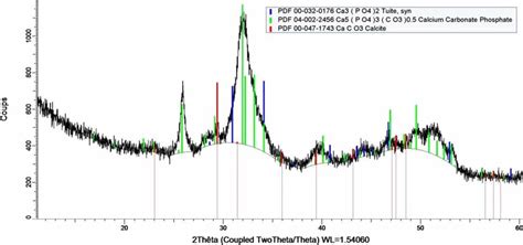 Phases Of The Clogging Material Investigated By X Ray Diffraction