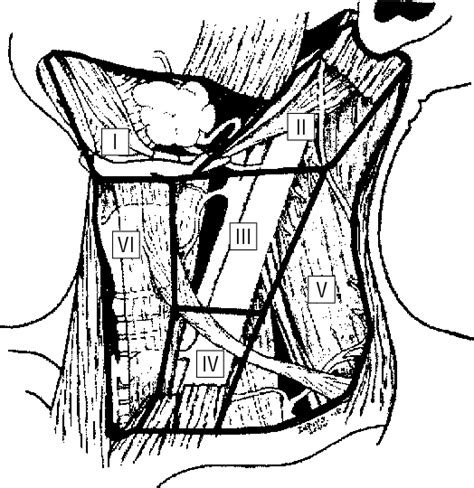 Table 1 From Neck Dissection Classification Update Revisions Proposed By The American Head And