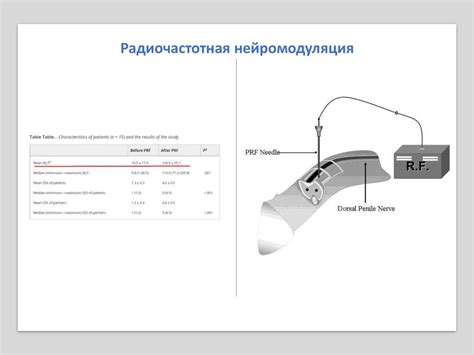 Хирургическое лечение преждевременной эякуляции - online presentation