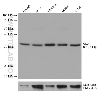 Slc25a16 Antibody 68107 1 Ig Proteintech 武汉三鹰生物技术有限公司