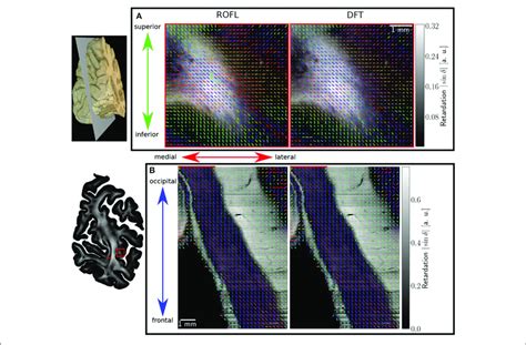 vectorfields obtained with the rofl algorithm left and the dft