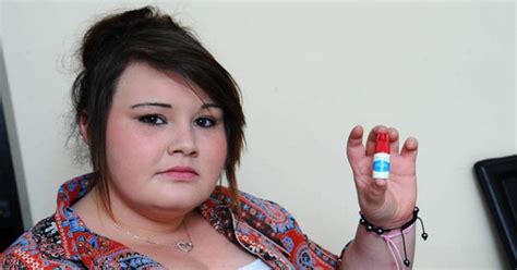 WARNING GRAPHIC CONTENT Teen S Finger ROTS After Using False Nail Glue Daily Star