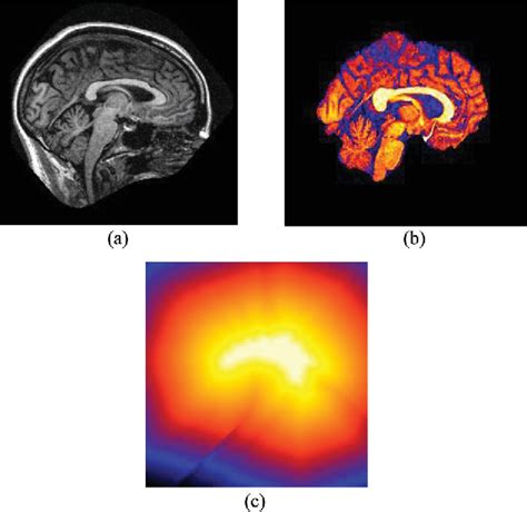 Figure 1 From Spatiotemporal Statistical Shape Model Construction For The Observation Of