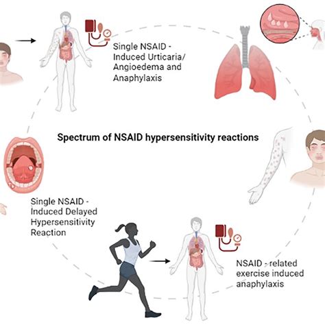 Spectrum Of Nsaid Hypersensitivity Reactions Aspirin Exacerbated Download Scientific Diagram