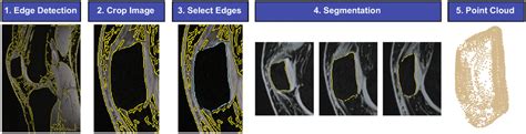 Semi Automatic Segmentation Steps For Isolating Bone From Either Mr Or