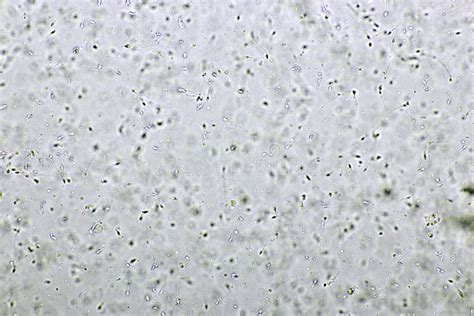 Sperm Microscope 400x