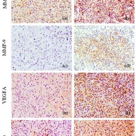 Representative Images Of The IHC Analysis Of MMP 2 A B MMP 9 C D Download Scientific