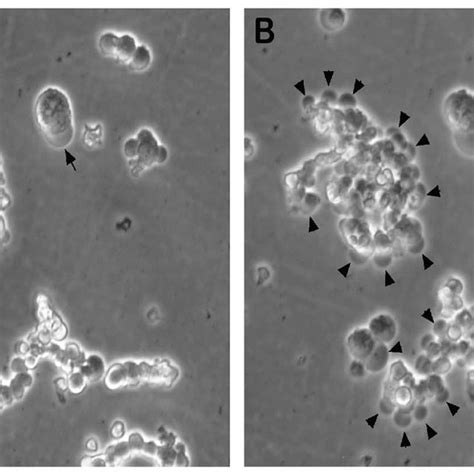 Membrane Blebbing In Treated Cells Weri Rb1 Cells Were Incubated For 3