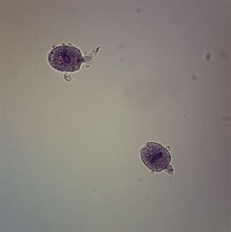 Beginners Protozoan Microscope Slide Set