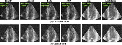 An Example Of Standard Plane Extraction Synthetic Dataset Noise 10