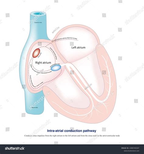 Categoría Inter Atrial Conduction Pathway De Fotos Imágenes E