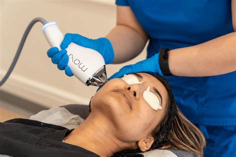 Moxi Laser Rejuvenation South William Clinic