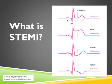 Ppt Icd 10 Cm And Icd 10 Pcs Coding Scenarios Powerpoint Presentation