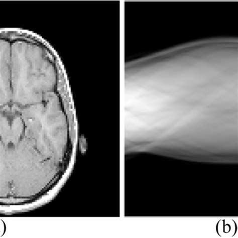 Radon Transformation Of Medical Images A Original Image B The