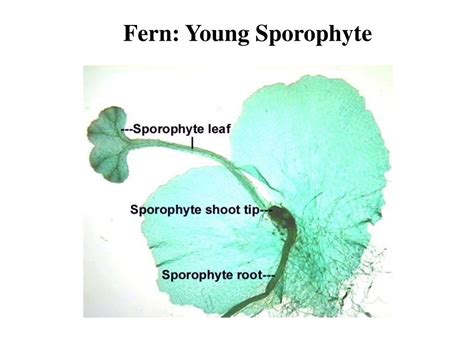 Fern Sporophyte Microscope