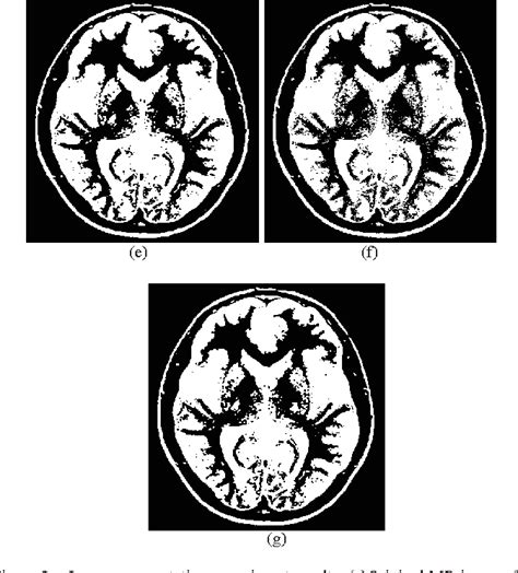 Figure 2 From Medical Image Segmentation Based On 2d Maximum Fuzzy Entropy And Improved Genetic