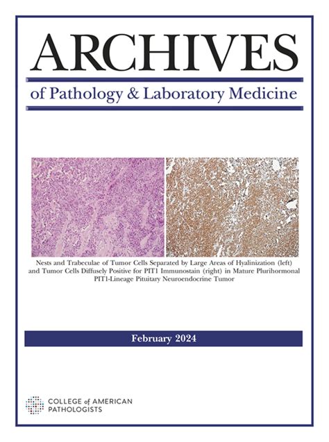 A Review Of Laboratory Practices Using The Hla B27 Survey By The