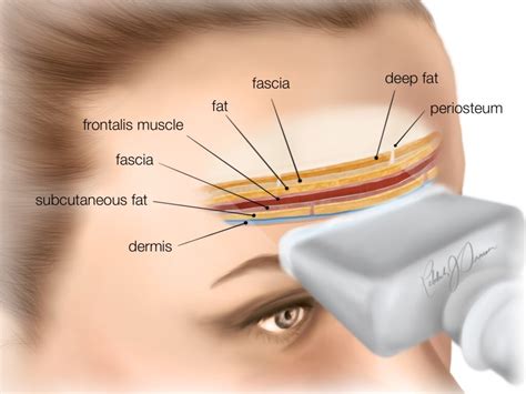 Academy Anatomy Forehead Cutaneous