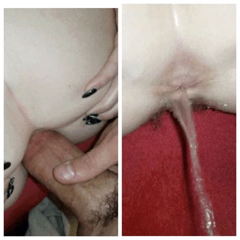 Enema Sexy Tumblr Com Tumbex