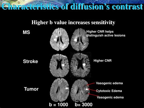 PPT DIFFUSION PERFUSION MRI IMAGING PowerPoint Presentation ID