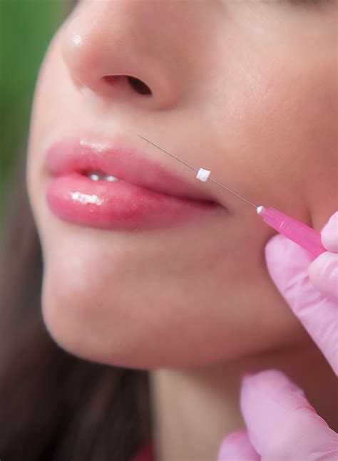 Miracu Pdo Threads Naples Fl The Laser Lounge Spa