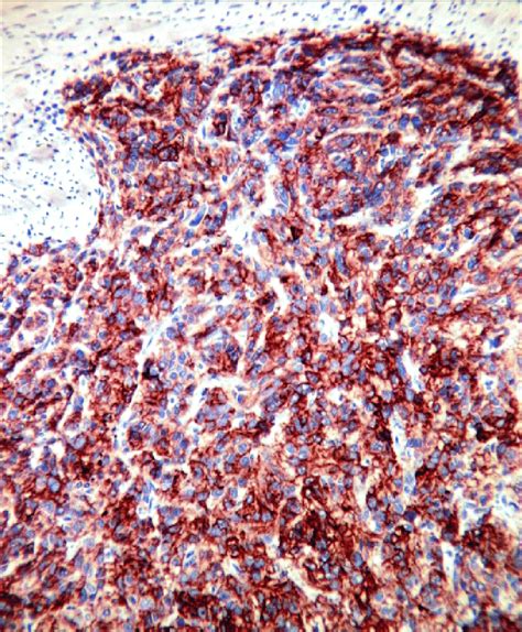 Gist Showing Kit Immunohistochemical Staining Download Scientific Diagram