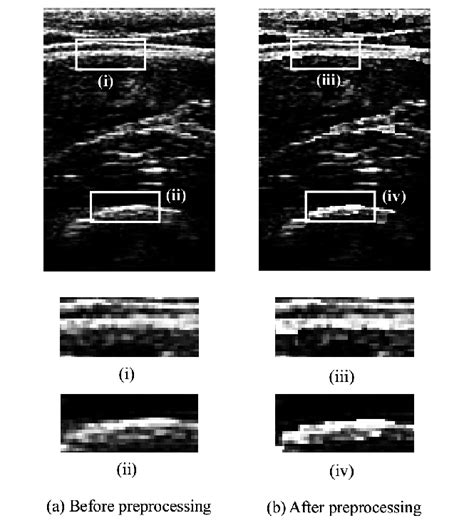 Example Of Preprocessing Results Download Scientific Diagram