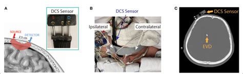 Figure E Diiuse Correlation Spectroscopy Dcs Experimental Setup A