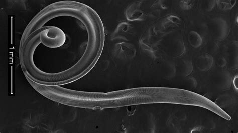 Diagnostic Dilemma A Woman Had Something In Her Eye — And It Turned