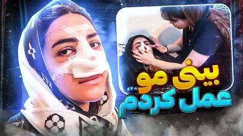 کلیپ خنده دار عمل کردن دماغ فاطمه و اذیت کردنش Youtube