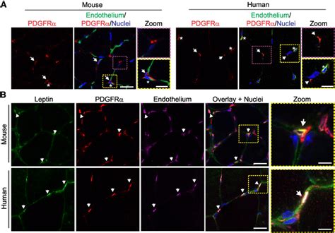 Co Localization Of Pdgfrα And Leptin Immunoreactivity A Immunostaining Download Scientific
