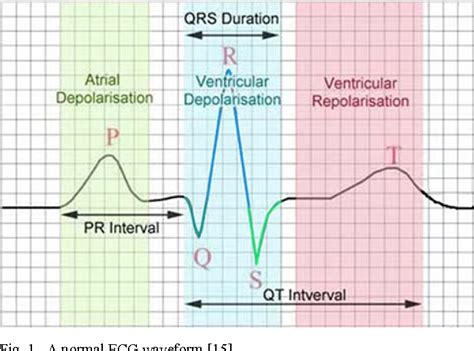 Figure 1 From An Efficient Wavelet Based Feature Extraction Scheme For Electrocardiogram Signals