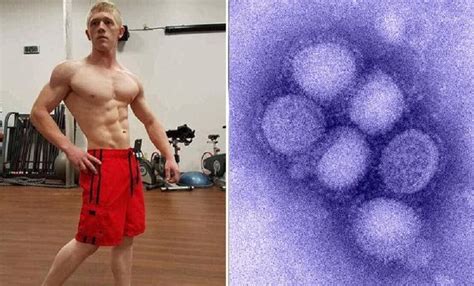 This Years Flu Bug Is So Deadly It Killed A Super Fit 21 Year Old