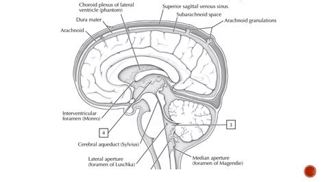 Colloid Cyst Image Of The Week Ppt