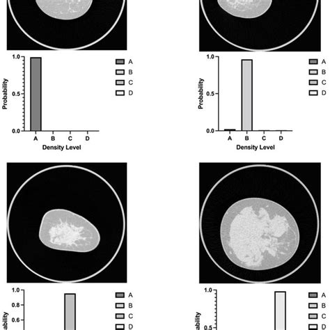 Example Dcnn Evaluations For Breast Ct Images Showing Different Density Download Scientific