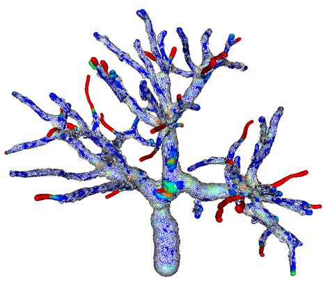 Generation Of Surface Models From Segmented Medical Image Data