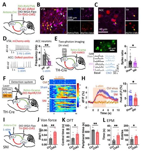 Nat Neurosci 西安交大王昌河团队揭示痛觉与情绪交互调控及慢性痛长期维持的神经闭环机制 财经头条 新浪财经