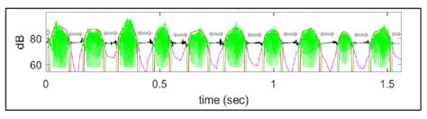 A Sample Wave Form From Male Participant In This Study Blue Arrows Download Scientific