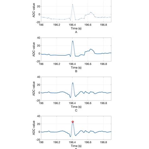 Electrocardiogram Waveform Modified By Signal Processing Procedure A
