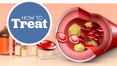 Treatment Options Beyond Statins In Drug Resistant Hypercholesterolemia