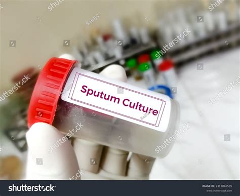 Sputum Specimen Collection Procedure With Rationale At Edward Gourley Blog